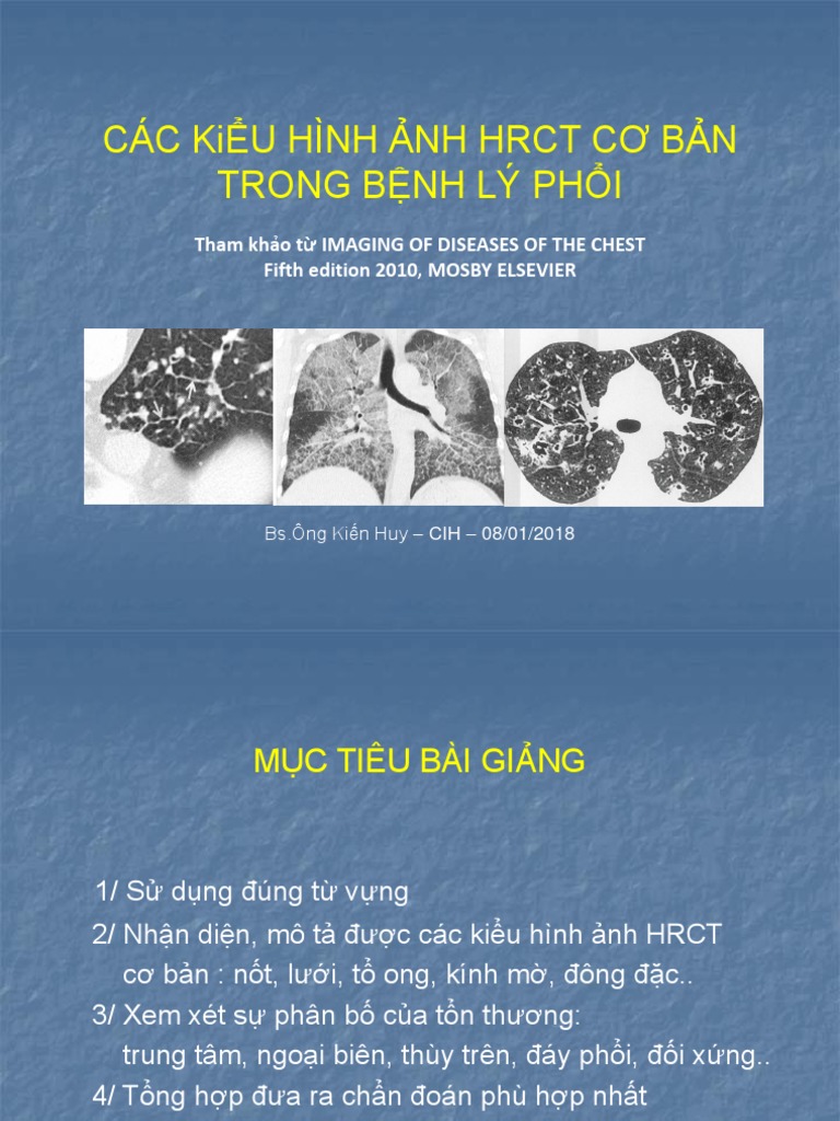 Basic HRCT Patterns of Lung Diseases | PDF