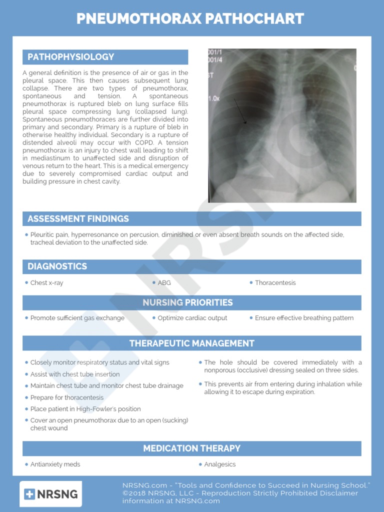 Pneumothorax Patho | PDF