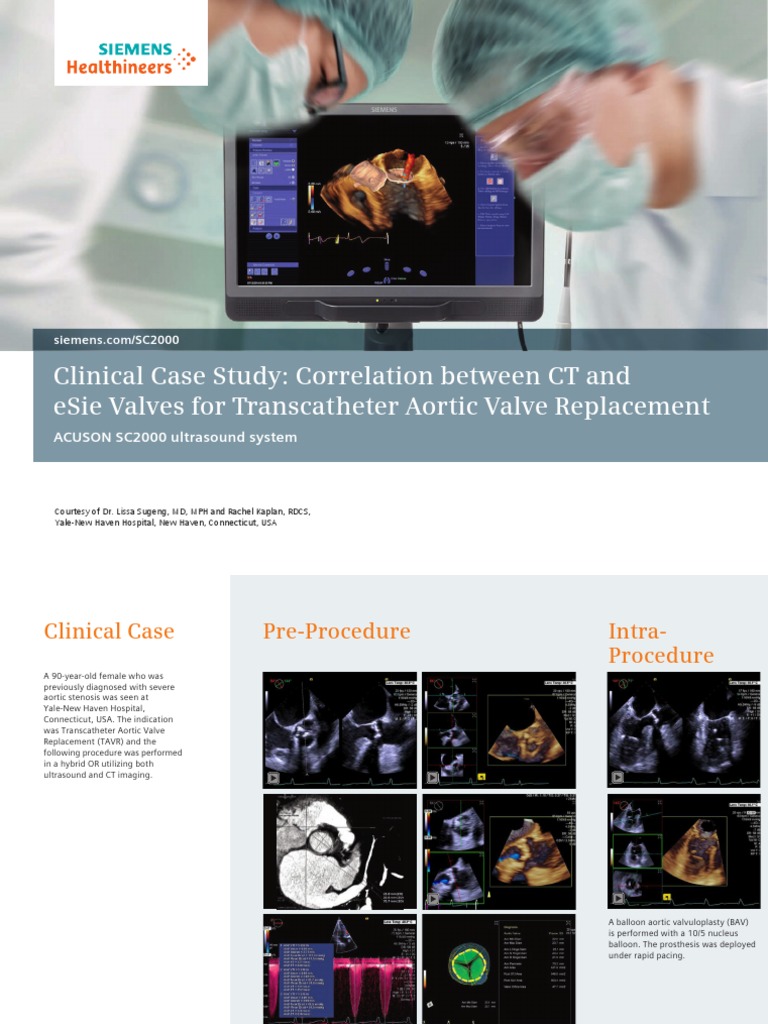 Siemens Acuson Sc2000 Clinical Case Study Tavr Tavi | PDF | Heart | Cardiovascular System