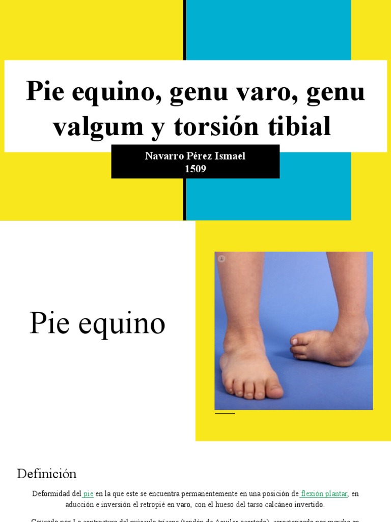 Pie Equino, Genu Varo y Valgo, Torsión Tibial | PDF | Rodilla | Pie
