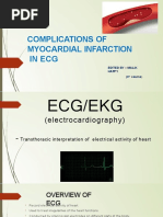 ECG Basics: Acute Myocardial Infarction | PDF | Electrocardiography ...