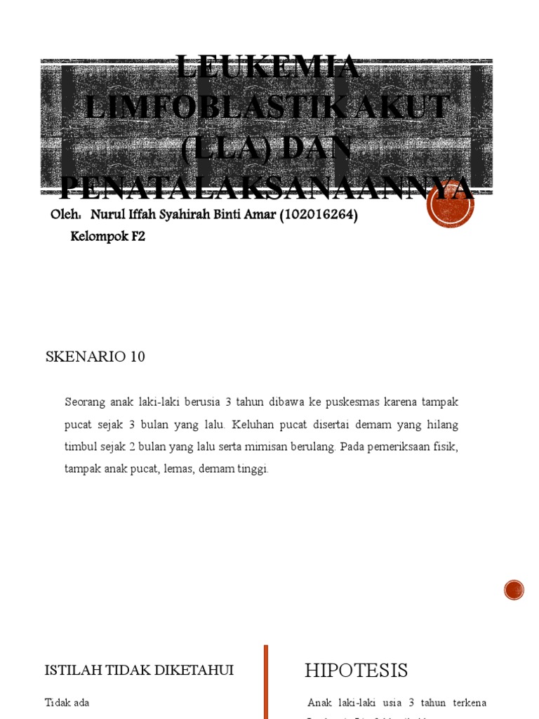 Leukemia Limfoblastik Akut | PDF