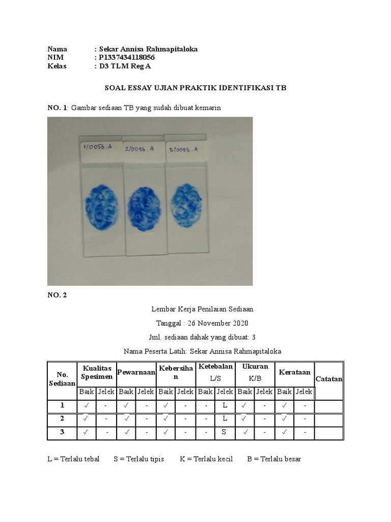 056 - Sekar Annisa - Uprak Iden TB | PDF