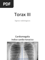 Signos Radiológicos Neumoperitoneo | PDF