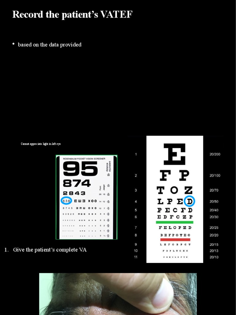 VATEF and Visual Acuity Records | PDF