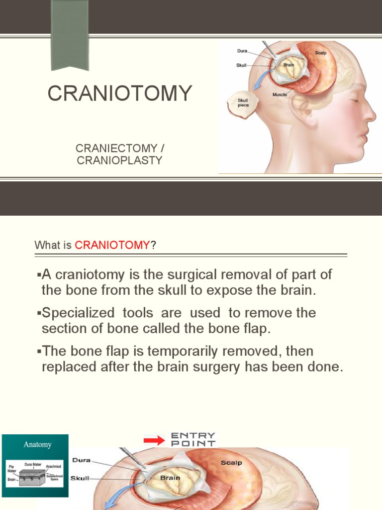 Craniotomy | PDF | Surgery | Clinical Medicine