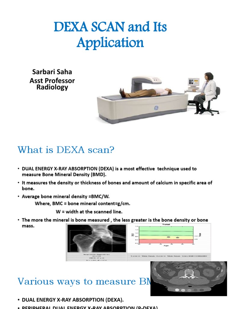 Dexa Scan and Its Application: Sarbari Saha Asst Professor Radiology ...