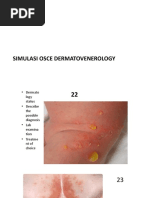 Patient-Scale POSAS-3.0 Generic-Scar English | PDF | Paresthesia | Medicine