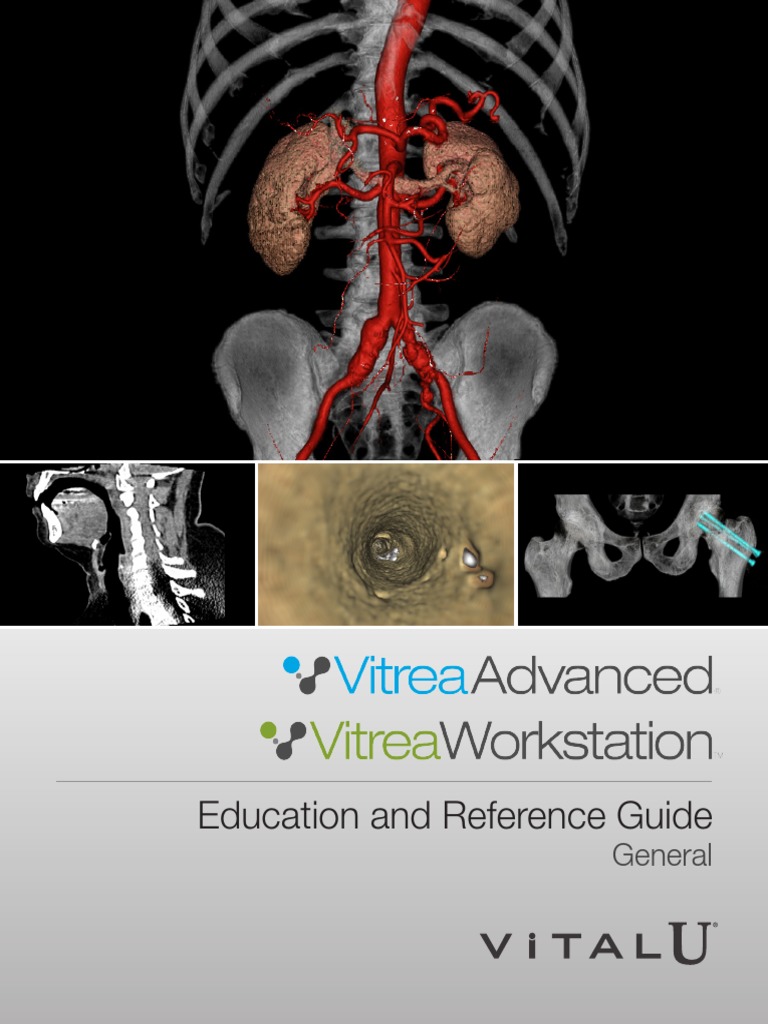 Vitrea Advanced General Edu Ref Guide | PDF | Computing | Computing And ...