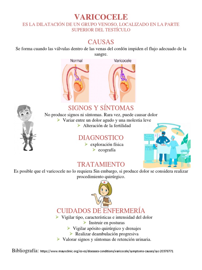 Varicocele: Causas, Síntomas y Tratamiento | PDF