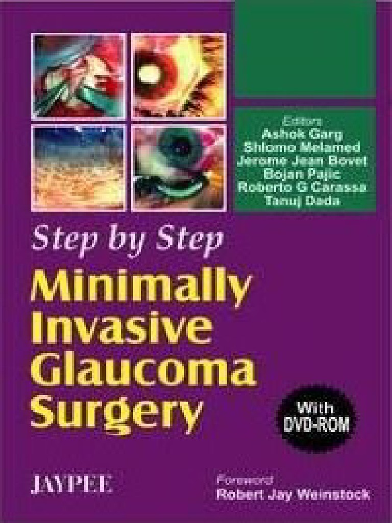Step by Step Minimally Invasive Glaucoma Surgery - Ashok Garg, 2006 ...