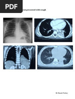 Imaging Techniques for Lung Collapse | PDF | Lung | Medical Specialties