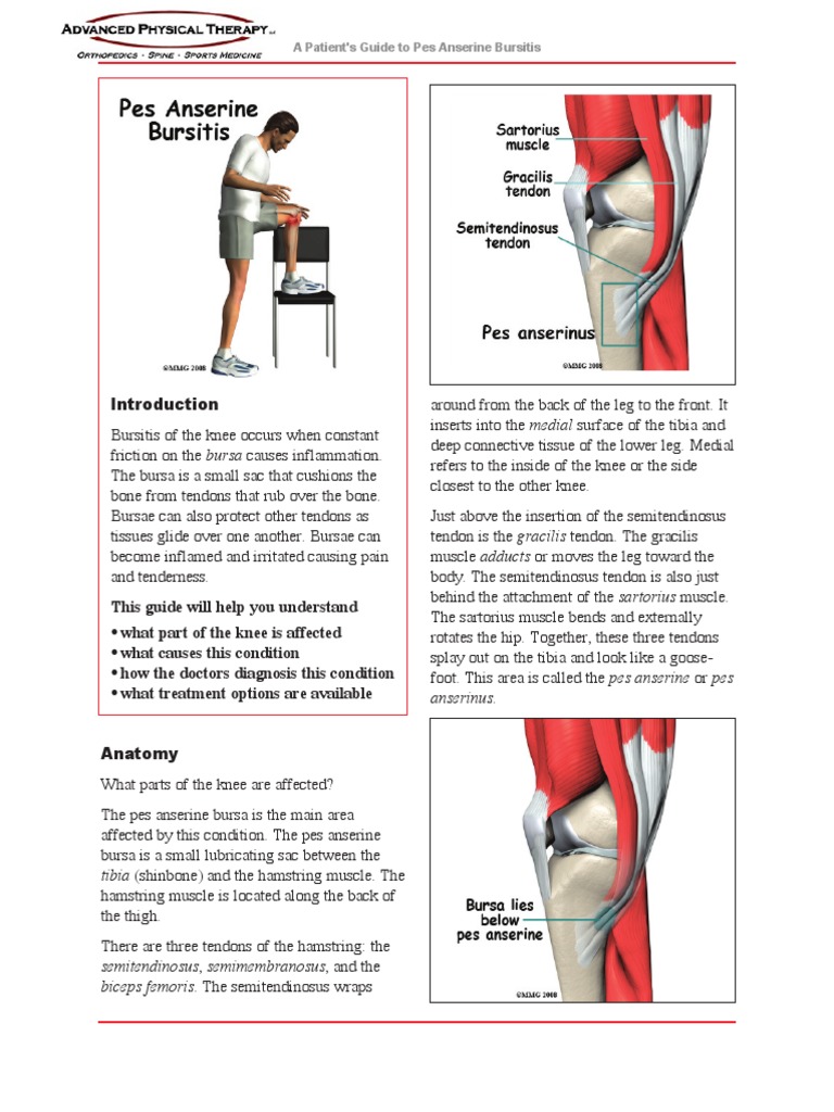 Pes Anserine Bursitis | PDF | Knee | Musculoskeletal System