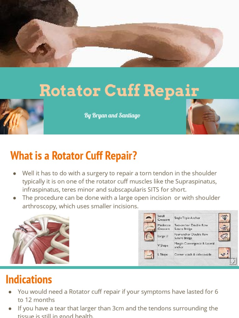 Post-Op Rotator Cuff Repair PP | PDF | Anatomical Terms Of Motion ...