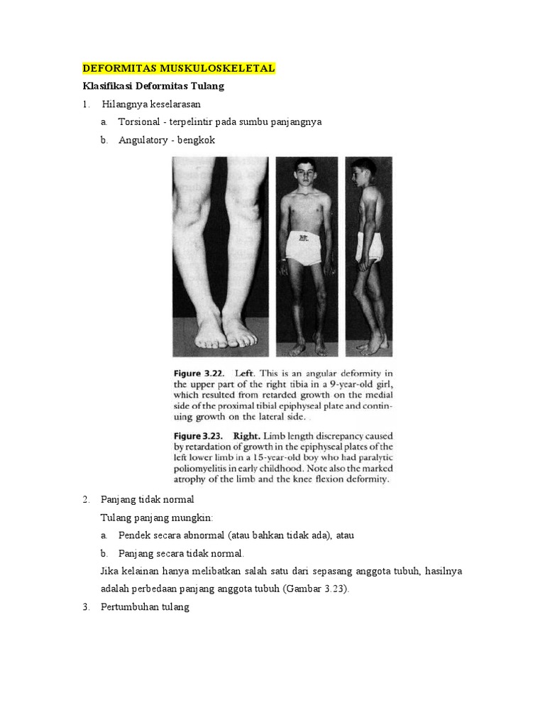 Deformitas Dan Fraktur | PDF