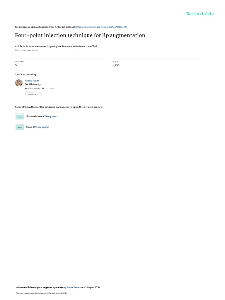 Four-Point Injection Technique For Lip Augmentation | PDF | Injection ...