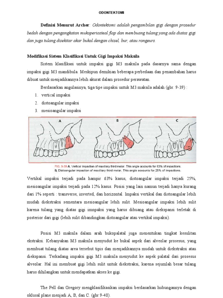 Teknik Odontektomi | PDF