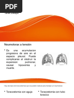 Guía de Toracostomía con Tubo: Técnica y Materiales | PDF | Tórax ...