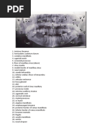Challacombe Scale ENG | PDF | Medical Specialties | Clinical Medicine