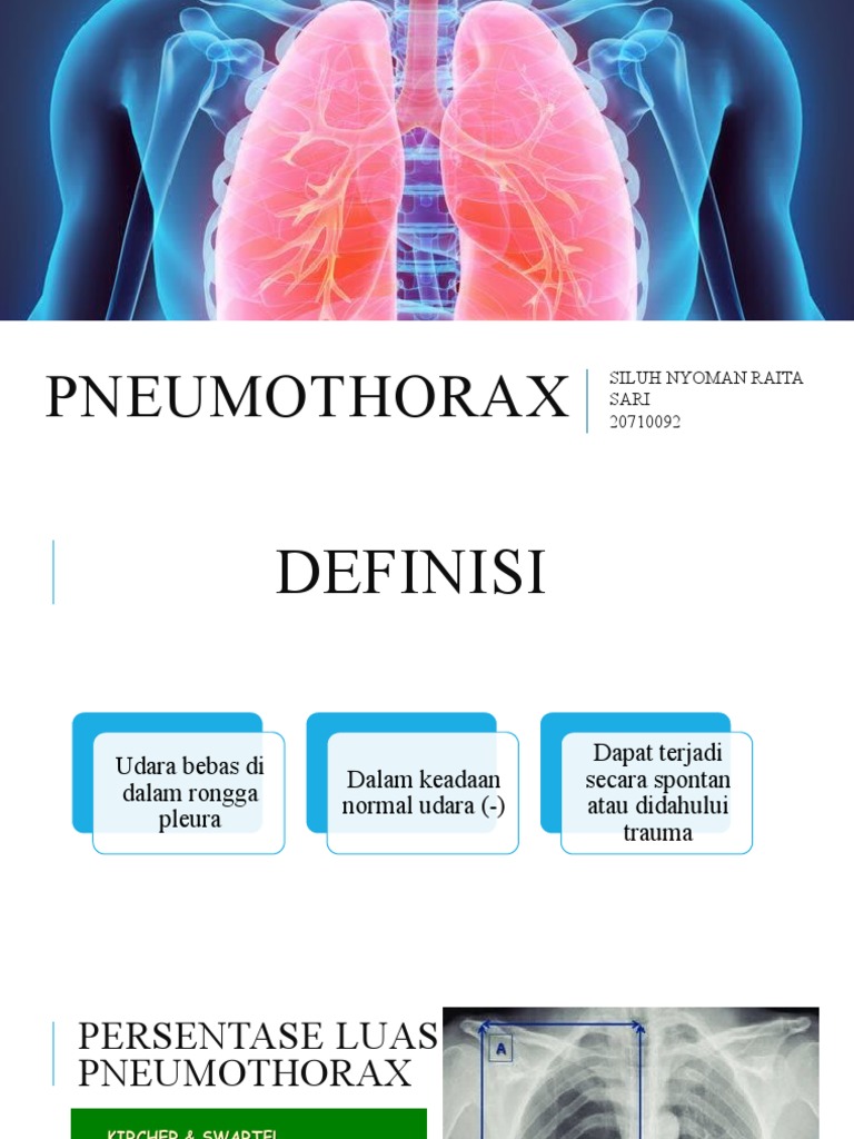 Pneumothorax | PDF