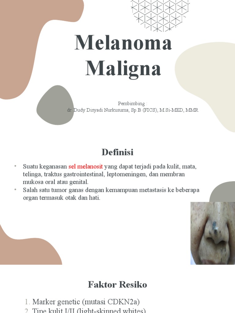 Melanoma Maligna Pdf