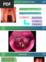 Nódulos y Pólipos Laríngeos: Guía Completa | PDF | Laringe | Anatomía ...