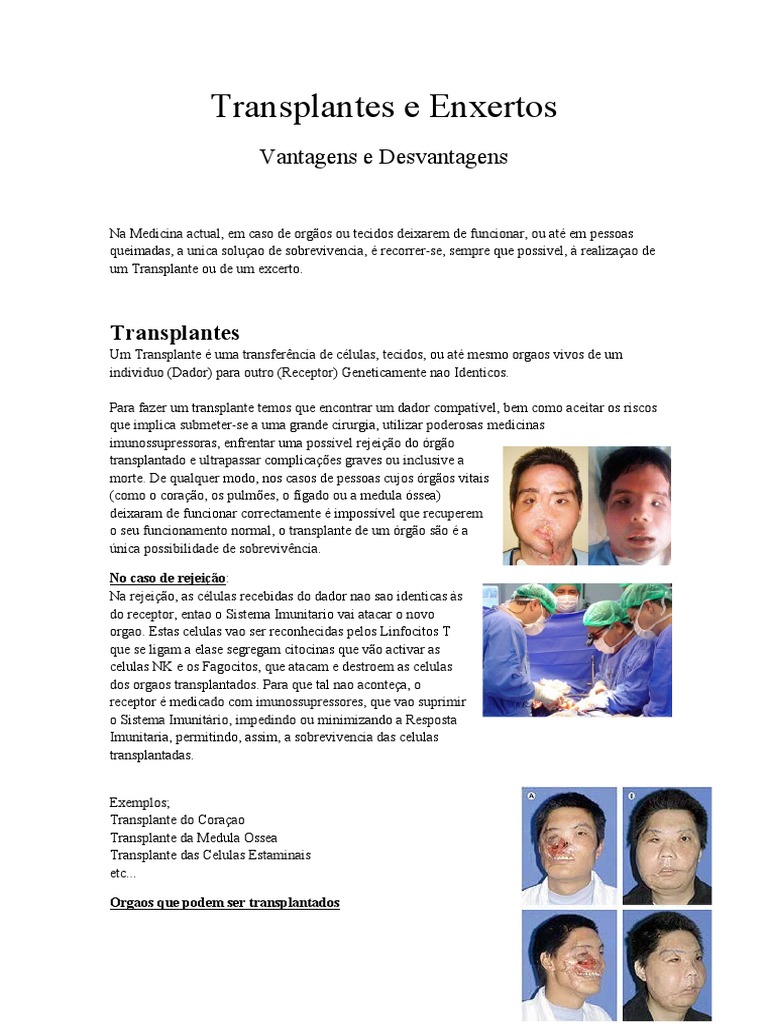 Transplantes e Enxertos | PDF | Transplante de órgãos | Osso