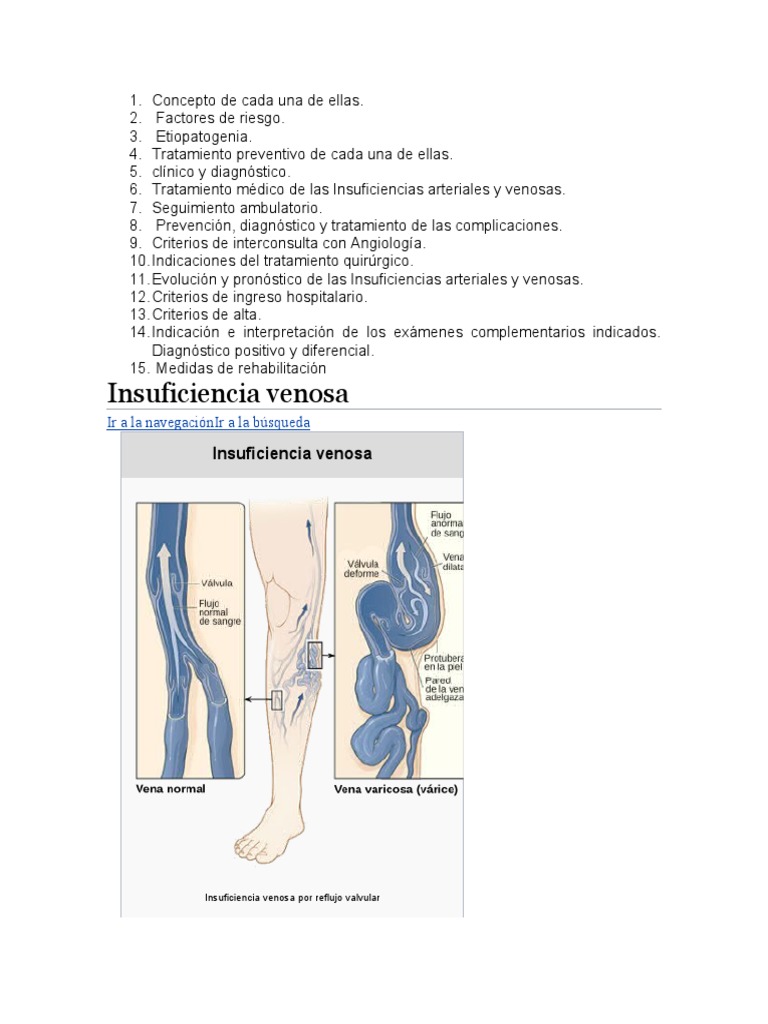 Infuciencia Venosa Wikipedia Mgi | PDF | Venas varicosas | Angiología