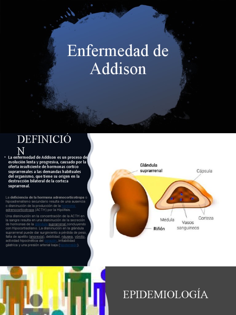 Enfermedad de Addison | PDF | Glándula suprarrenal | Hormona ...