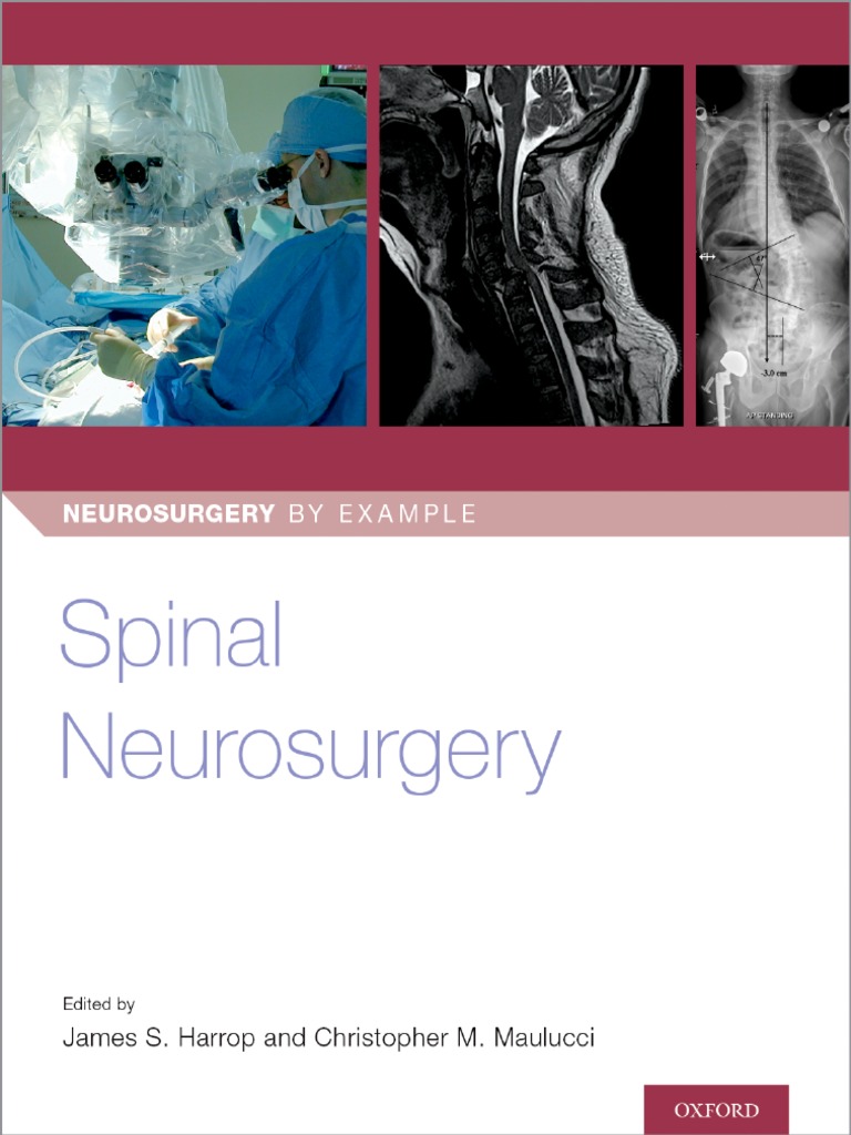 2019 Neurosurgery by Example - Spinal Neurosurgery | PDF | Neurosurgery ...