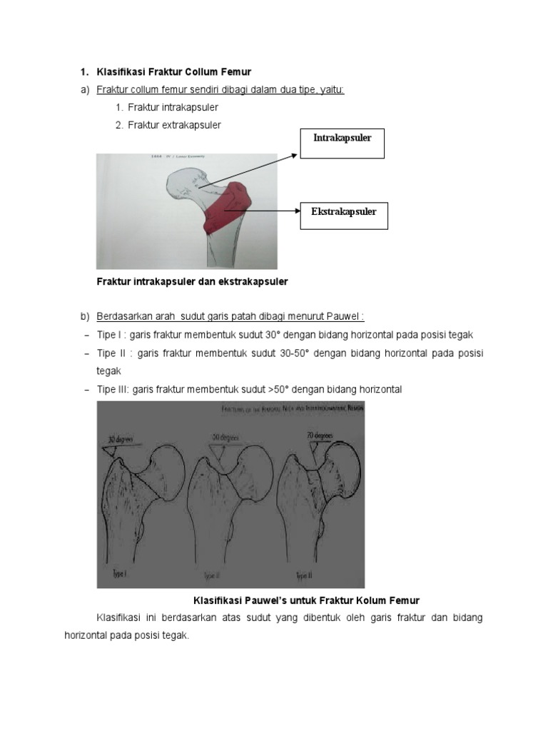 Klasifikasi dan Gejala Fraktur Femur | PDF | Sejarah