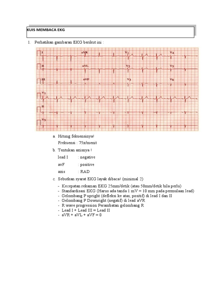 Latihan EKG | PDF