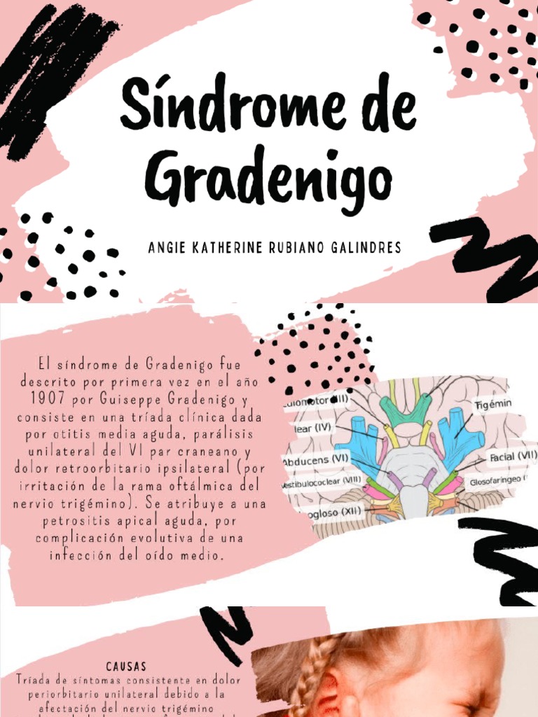 Sindrome de Gradenigo | PDF