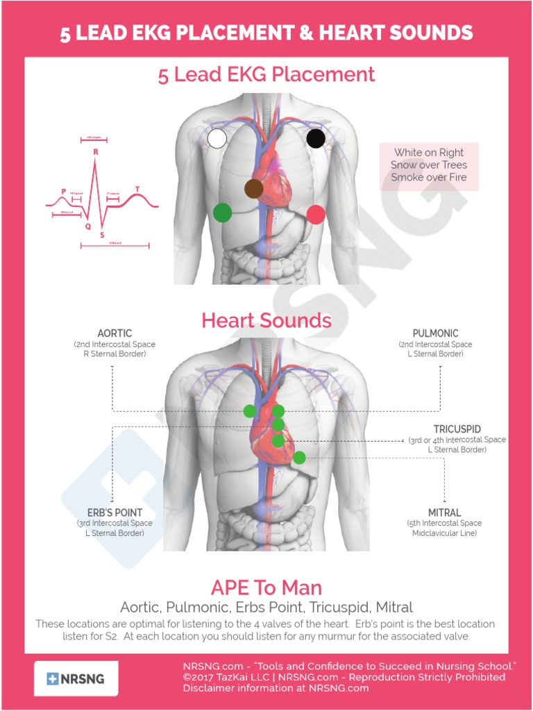 Cardiac 1.01 5 Lead EKG Placement | PDF