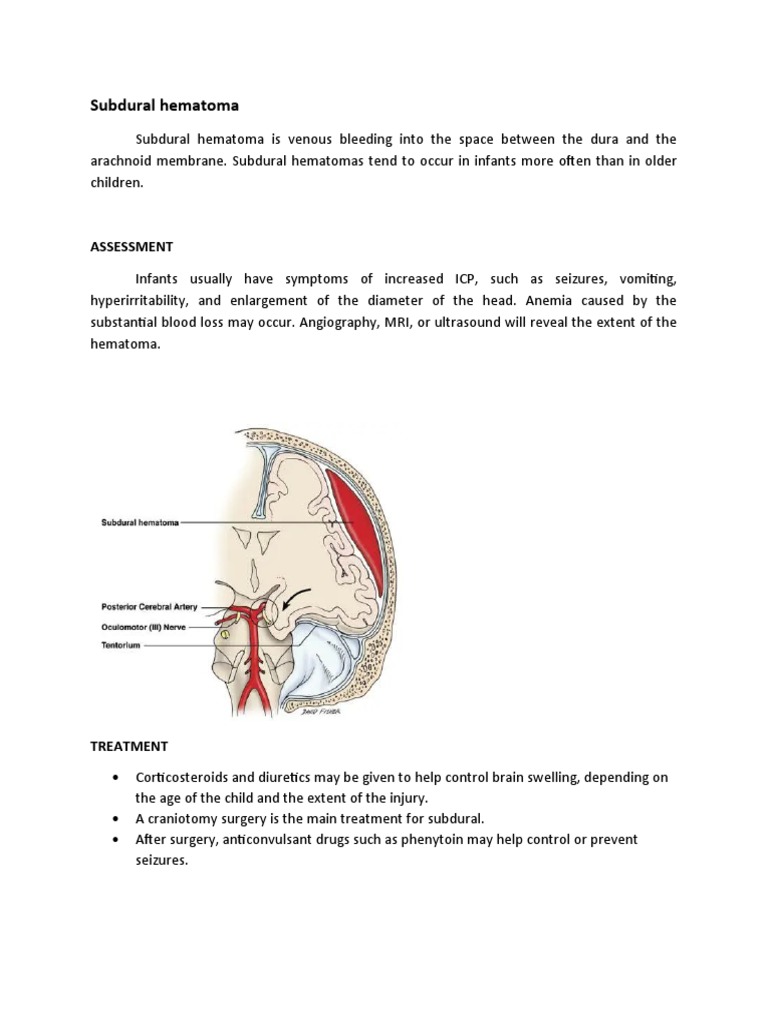 Subdural Hematoma | PDF