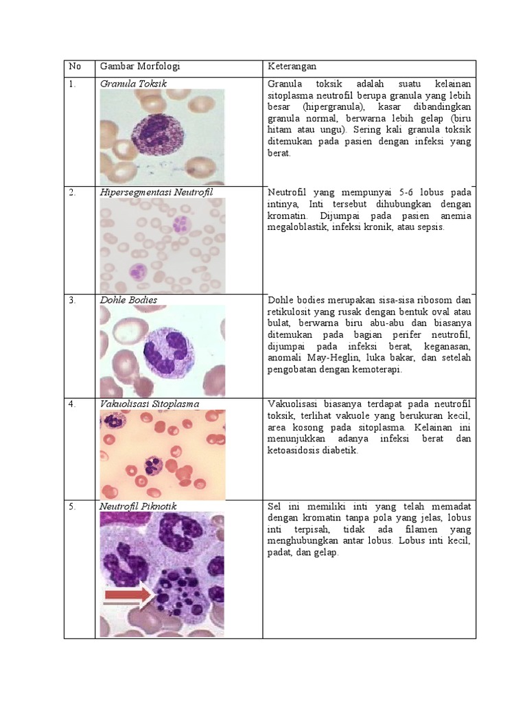 Kelainan Morfologi Sel Leukosit | PDF