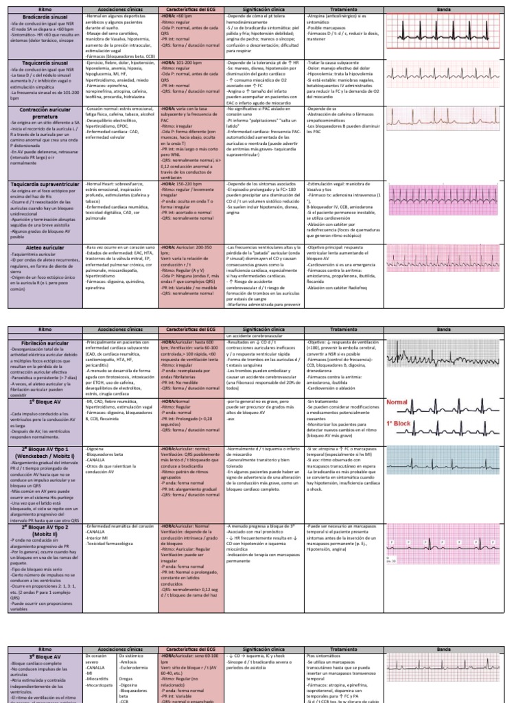 Ritmos Patologicos Ecg | PDF | Electrofisiologia | Rtt