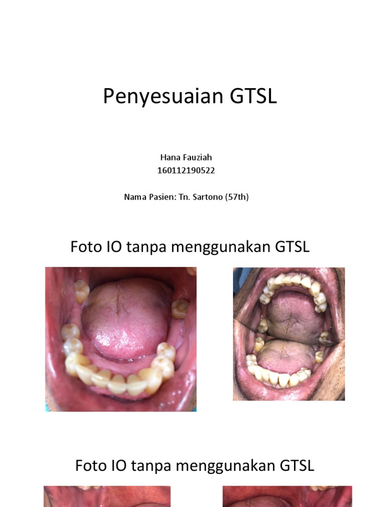 Penyesuaian GTSL: Hana Fauziah 160112190522 Nama Pasien: Tn. Sartono (57th) | PDF