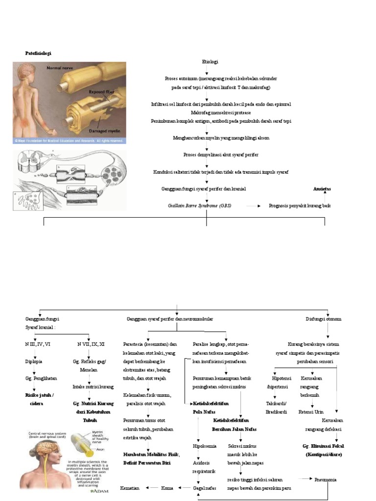 Patofisiologi: Guillain Barre Syndrome (GBS) | PDF