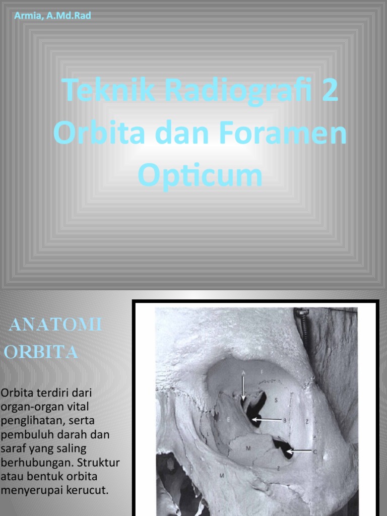 Foramen Opticum Dan Orbita | PDF