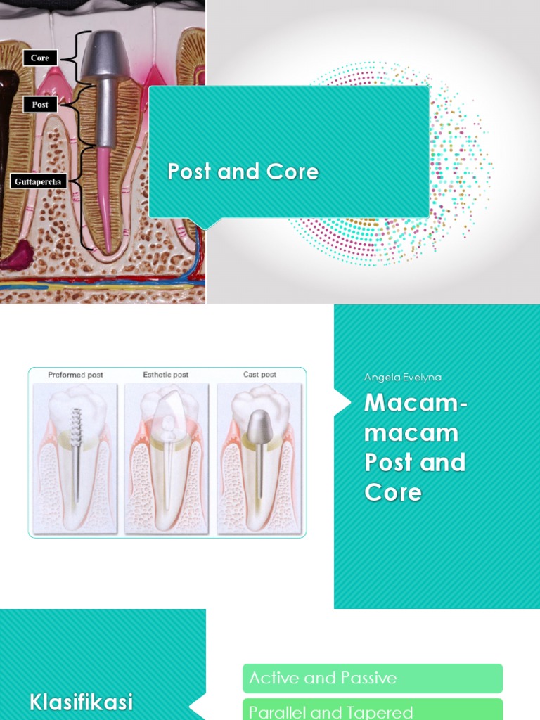 Post Core Lutting Cement | PDF