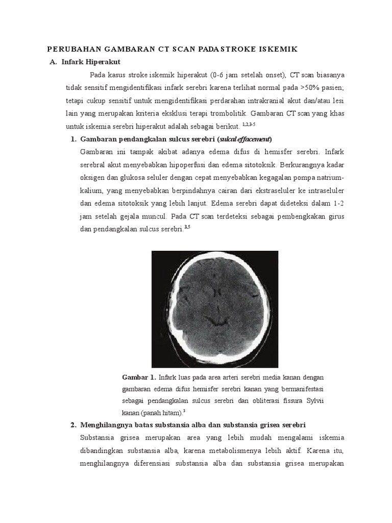Perubahan Gambaran CT Scan | PDF | Ilmu Sosial | Perjalanan