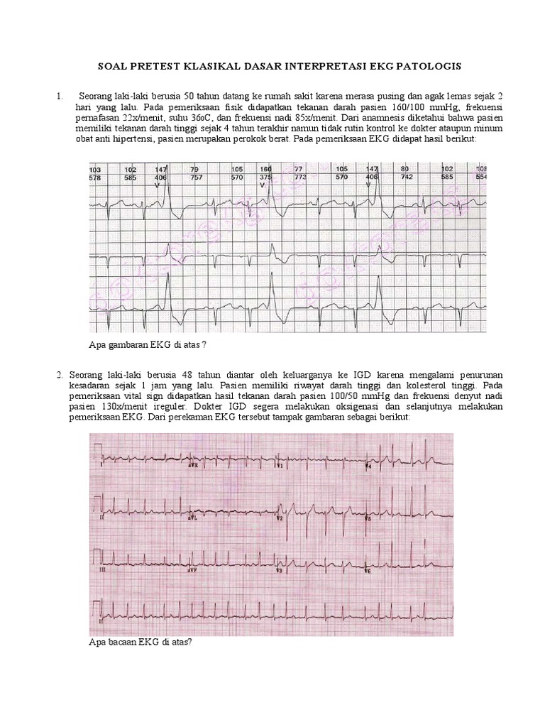Soal Interpretasi EKG Patologis Dasar | PDF