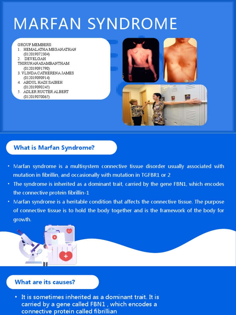 Marfan Syndrome Presentation | PDF | Medical Specialties ...
