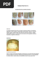 Anatomia de La Uña | PDF | Clavo (anatomía) | Epidermis
