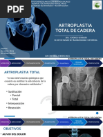 Protesis de Thompson Espanol SCECLE | PDF | Cirugía | Medicina CLINICA