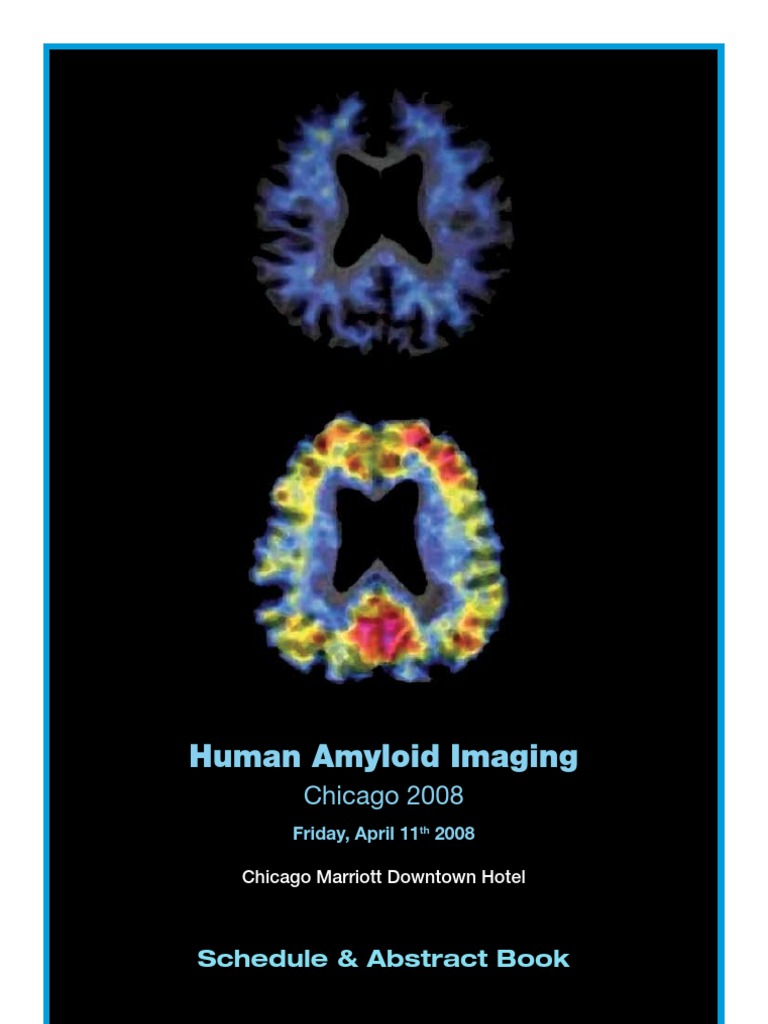 Human Amyloid Imaging: Chicago 2008 | PDF | Amyloid Beta | Alzheimer's ...