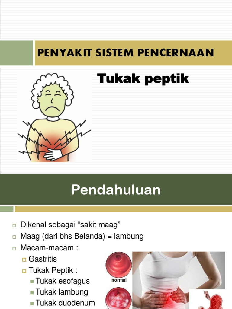 Tukak Peptik 2019 | PDF