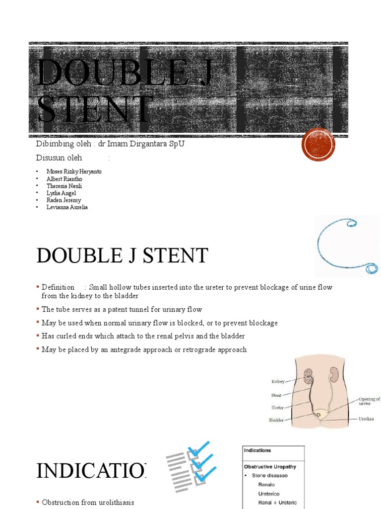 Double J Stent Overview and Guidelines | PDF