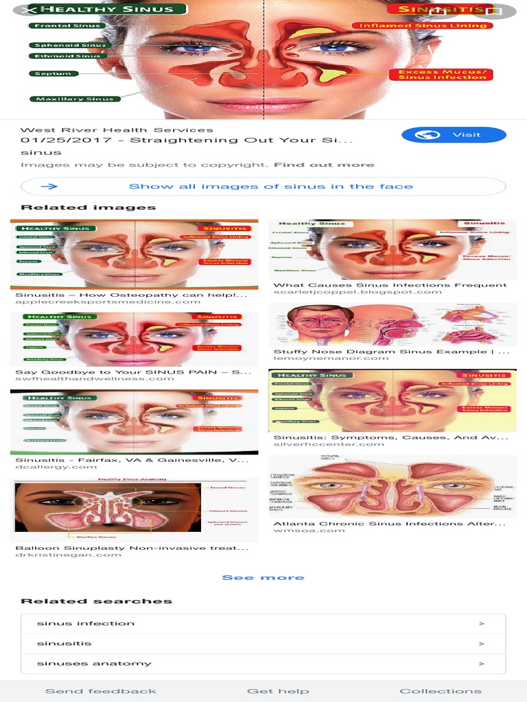 Sinus in The Face - Google Search | Download Free PDF | Human Nose | Face